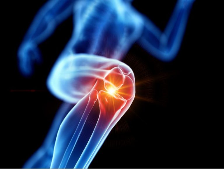 Rodilla : Clínica Ciudad del Mar